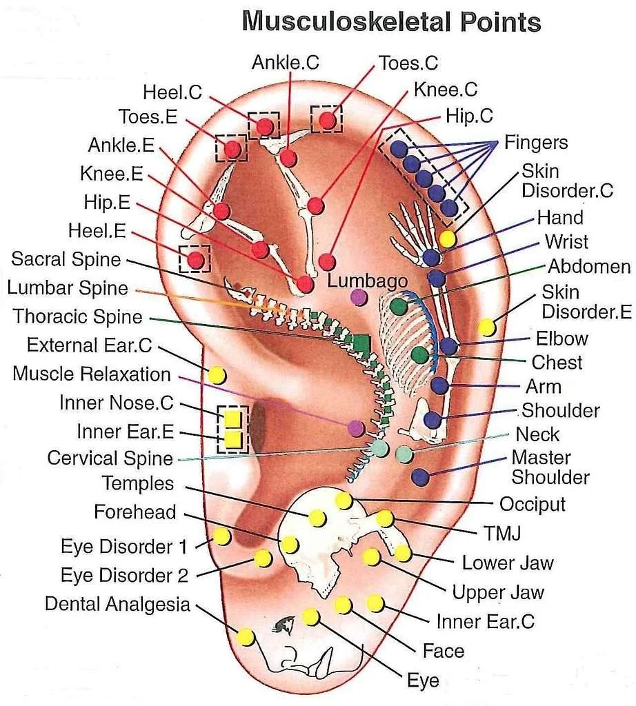 Battlefield Acupuncture: The Military's Secret Weapon Against Chronic ...