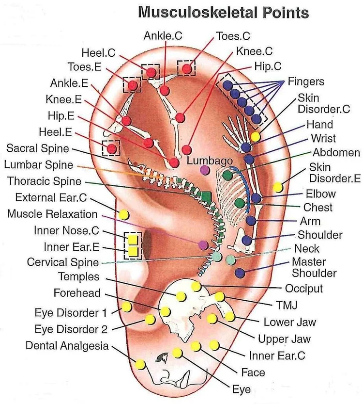 Battlefield Acupuncture: The Military's Secret Weapon Against Chronic ...