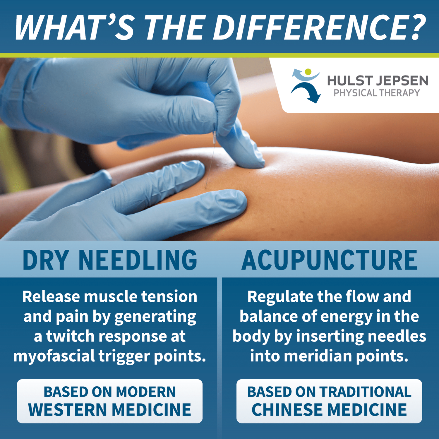Why is Dry Needling Illegal? Common Misconceptions & Legal History ...