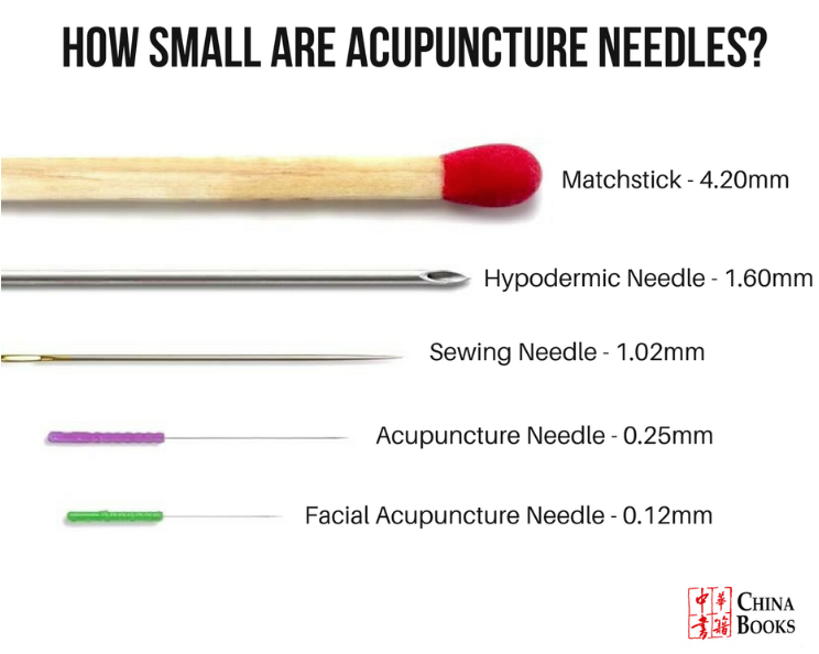 How Deep Do Acupuncture Needles Go? An In-Depth Look (2024) — Holistic ...