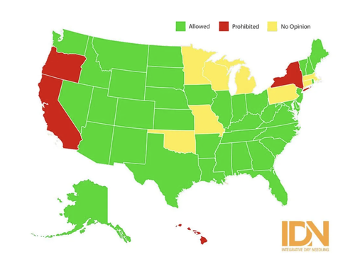 Why is Dry Needling Illegal? Common Misconceptions & Legal History ...