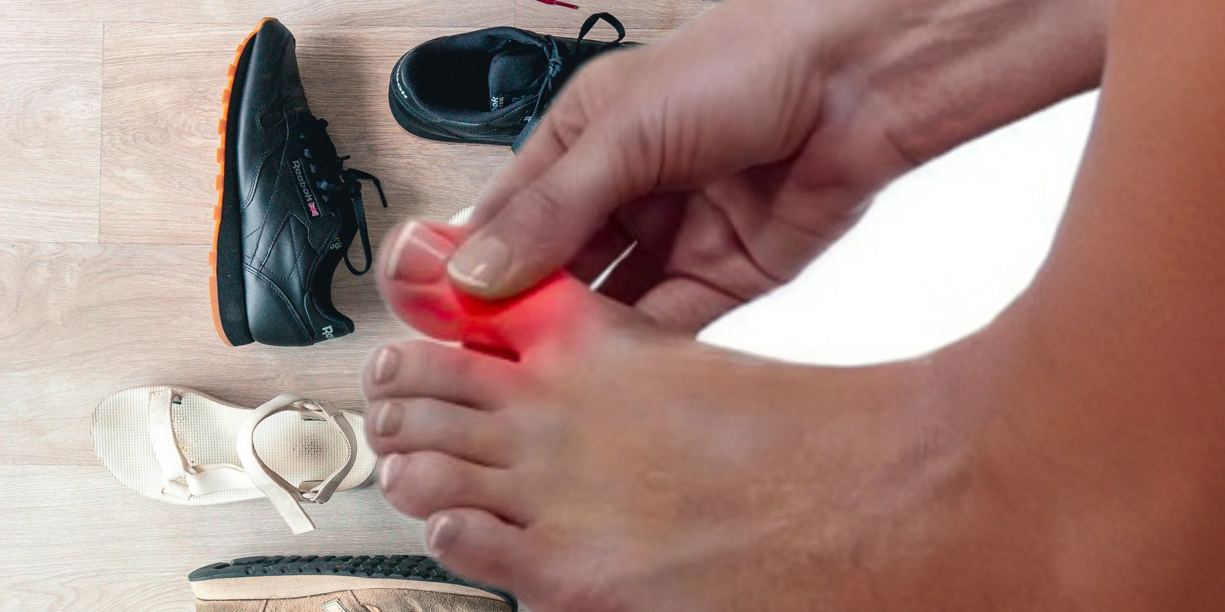 The Impact of Footwear on Hallux Rigidus: What You Need to Know — Tea ...