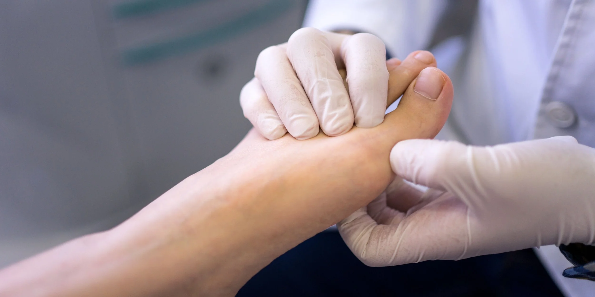What It Really Takes to Heal a Foot Ulcer — Beyond Just Bandages — Tea ...