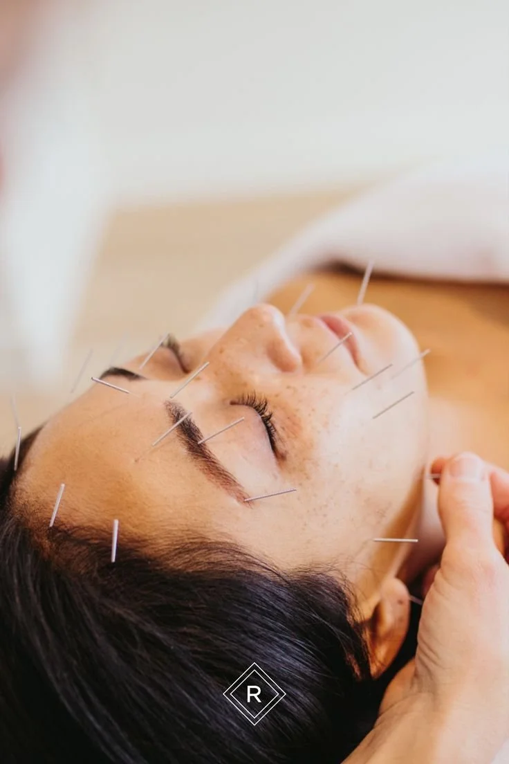 The Acupuncture & Herbal Clinic | Hope Island