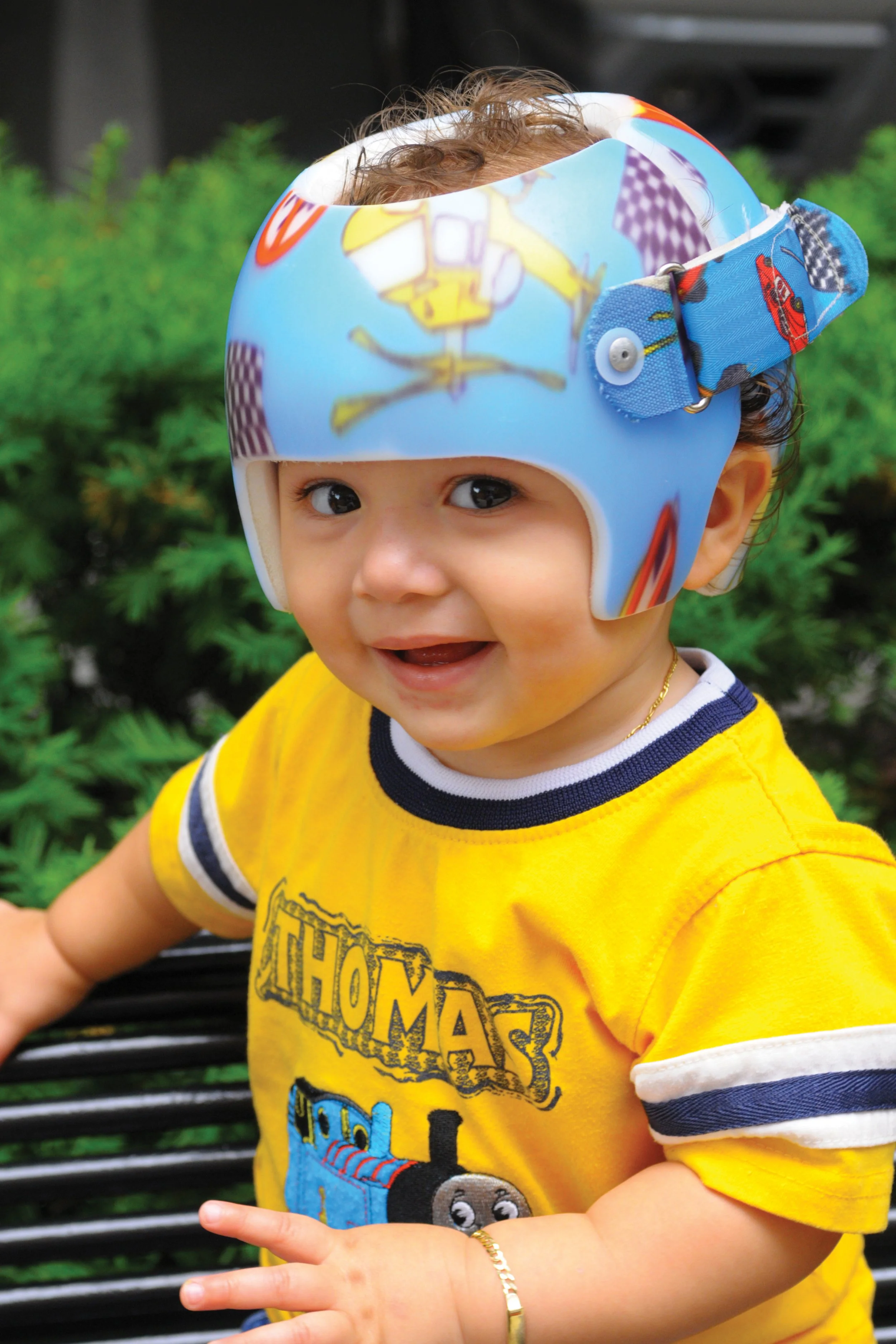 Expert Cranial Remolding Therapy in Calgary, AB | Head Shape Clinic ...