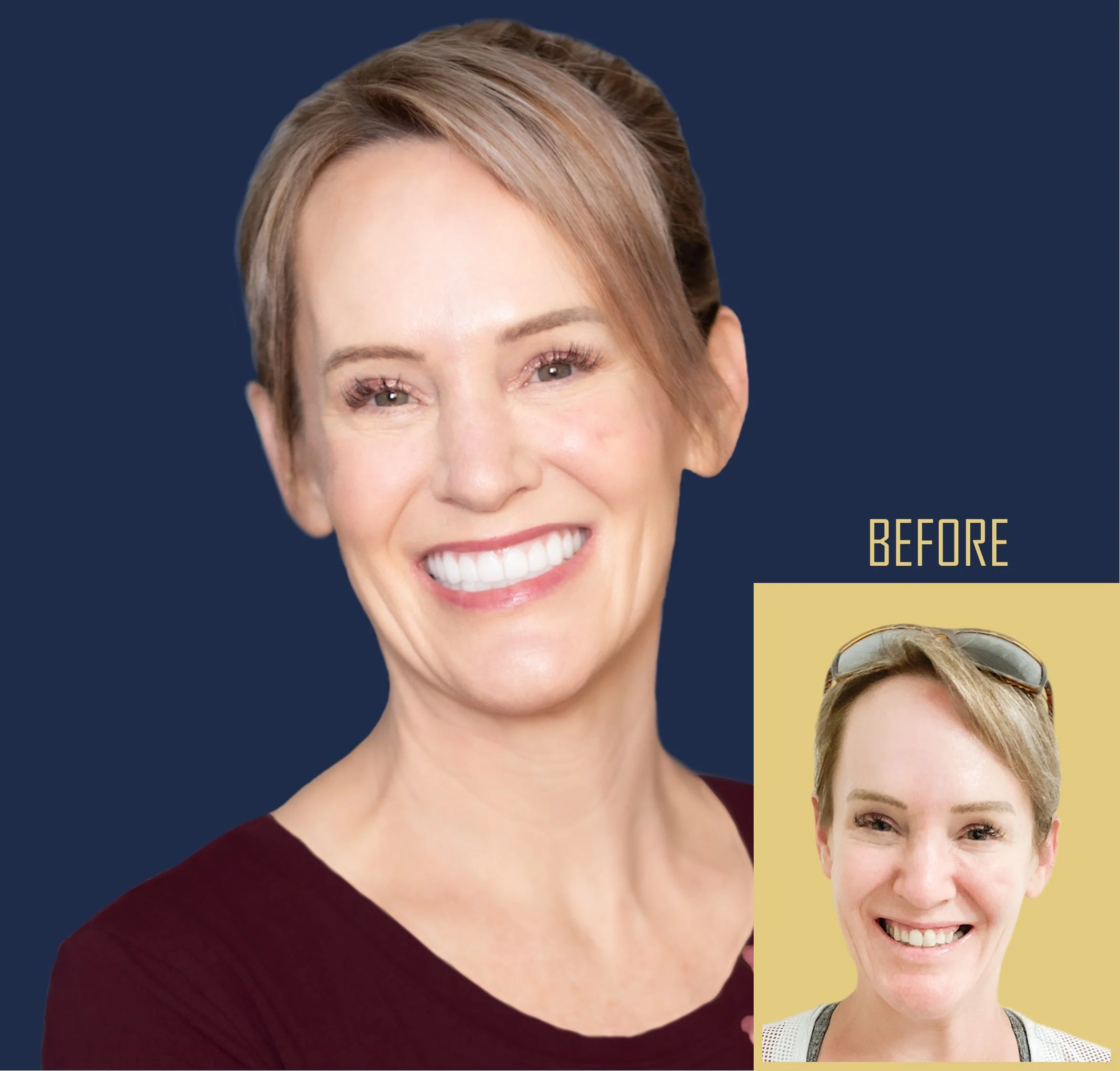 Oregon City Same Day Smile — Pioneer Dental Group