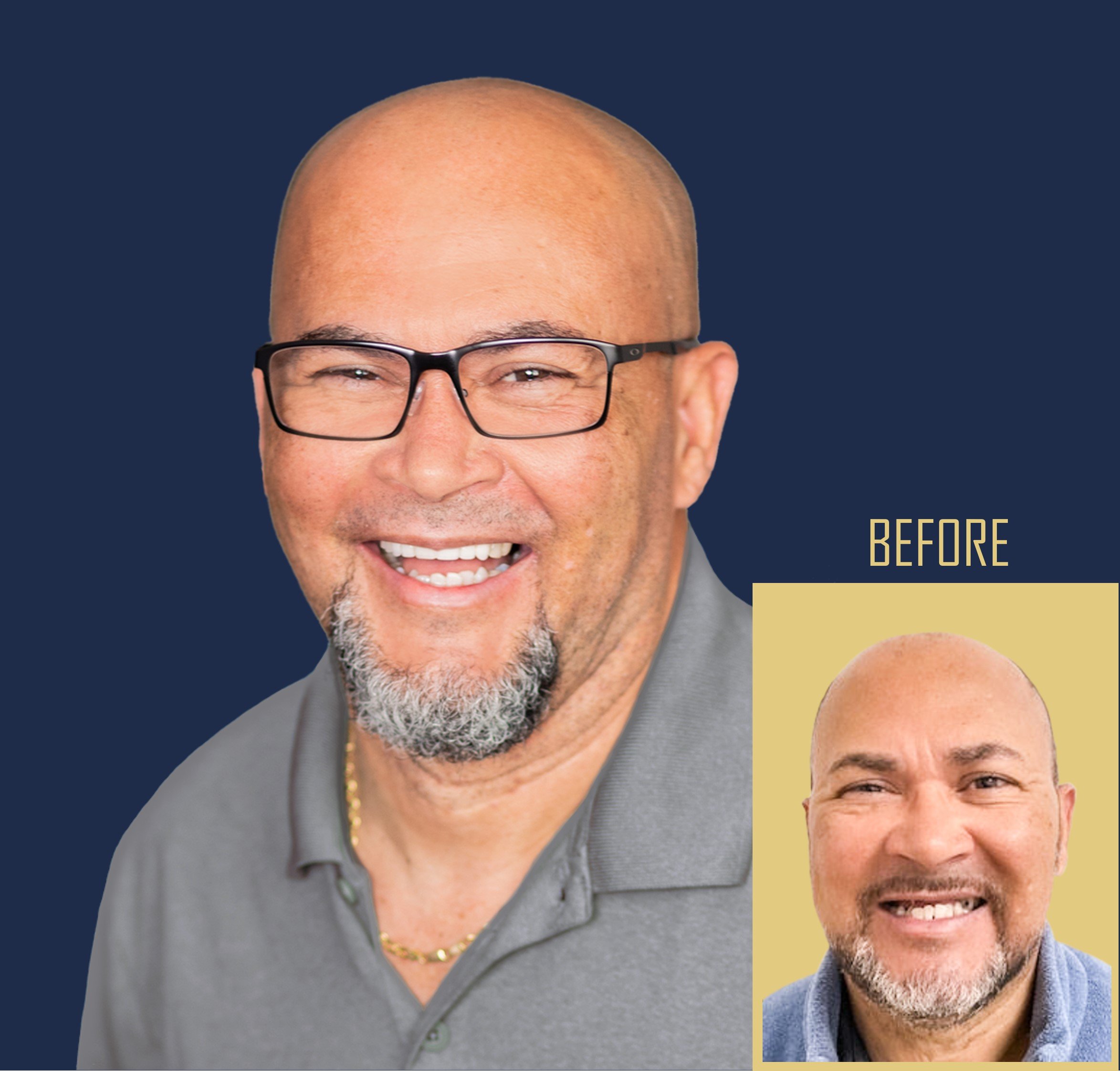 Oregon City Same Day Smile — Pioneer Dental Group