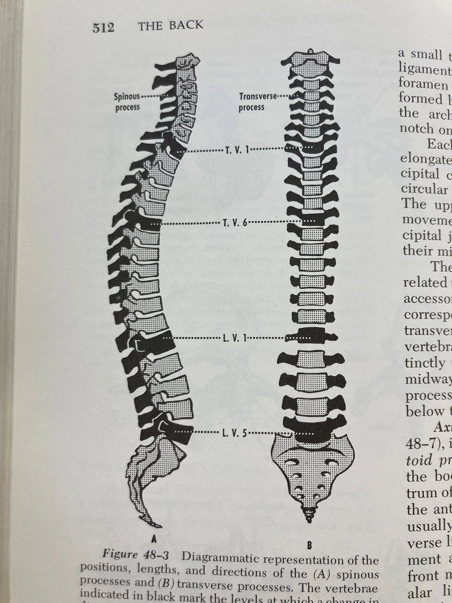 Understanding a Prolapsed/Herniated Disc of the Lumbar Spine — Waiuku ...