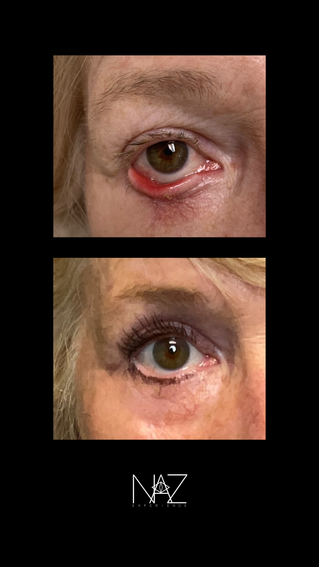 Before & After Gallery | The Naz Experience | Dr. Maryam Nazemzadeh ...