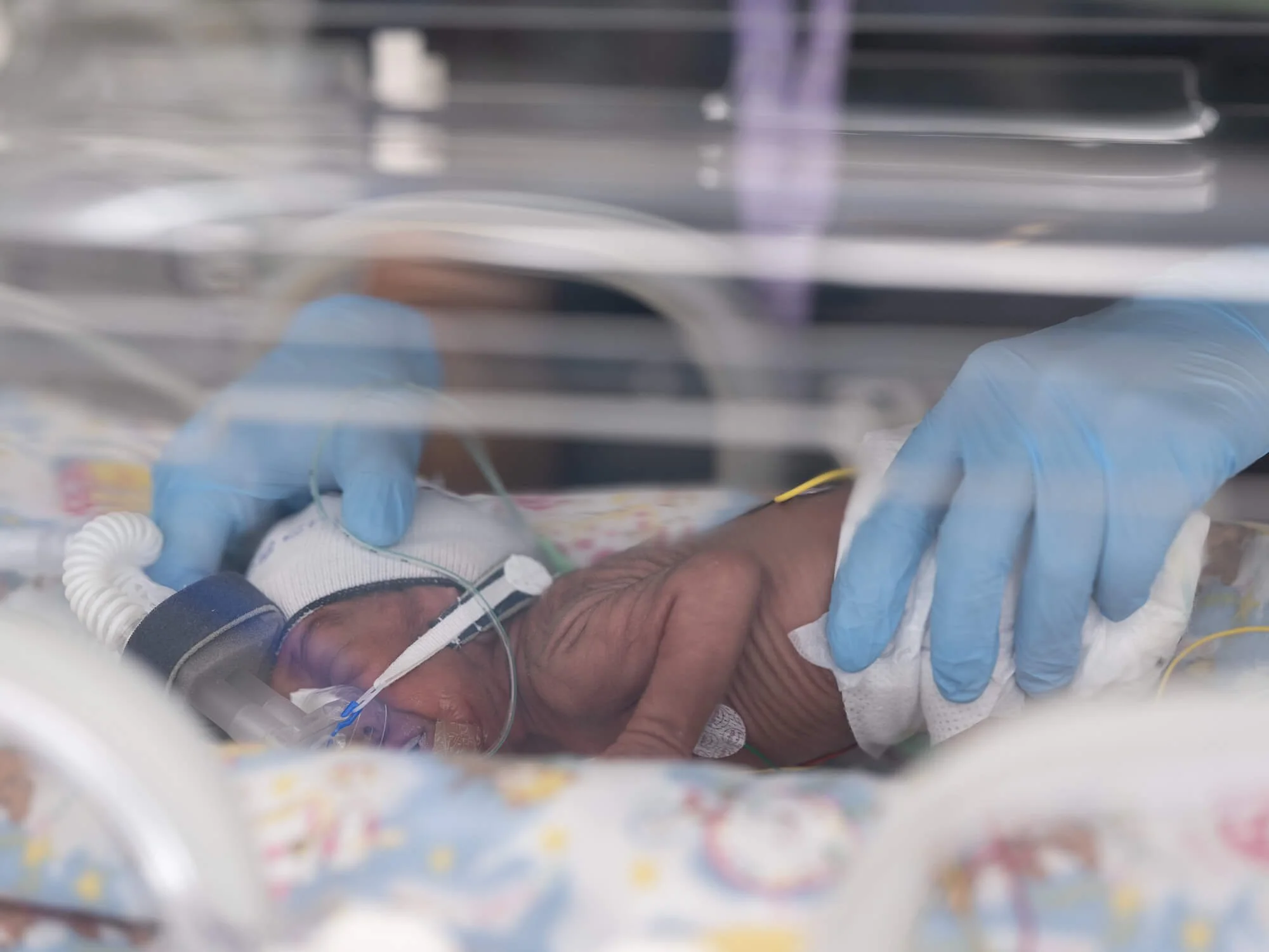 The Coombe Hospital | Dublin | Neonatal Intensive Care Unit NICU — The ...