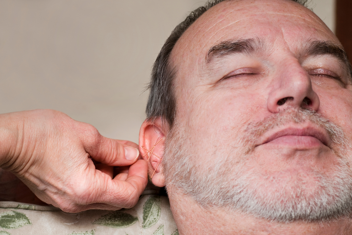 Why You Need To Give 5NP Acupuncture A Try — Redwood Acupuncture and Herbs