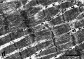 Understanding Muscle Fiber Damage in Runners — Running Niche