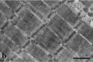 Understanding Muscle Fiber Damage in Runners — Running Niche