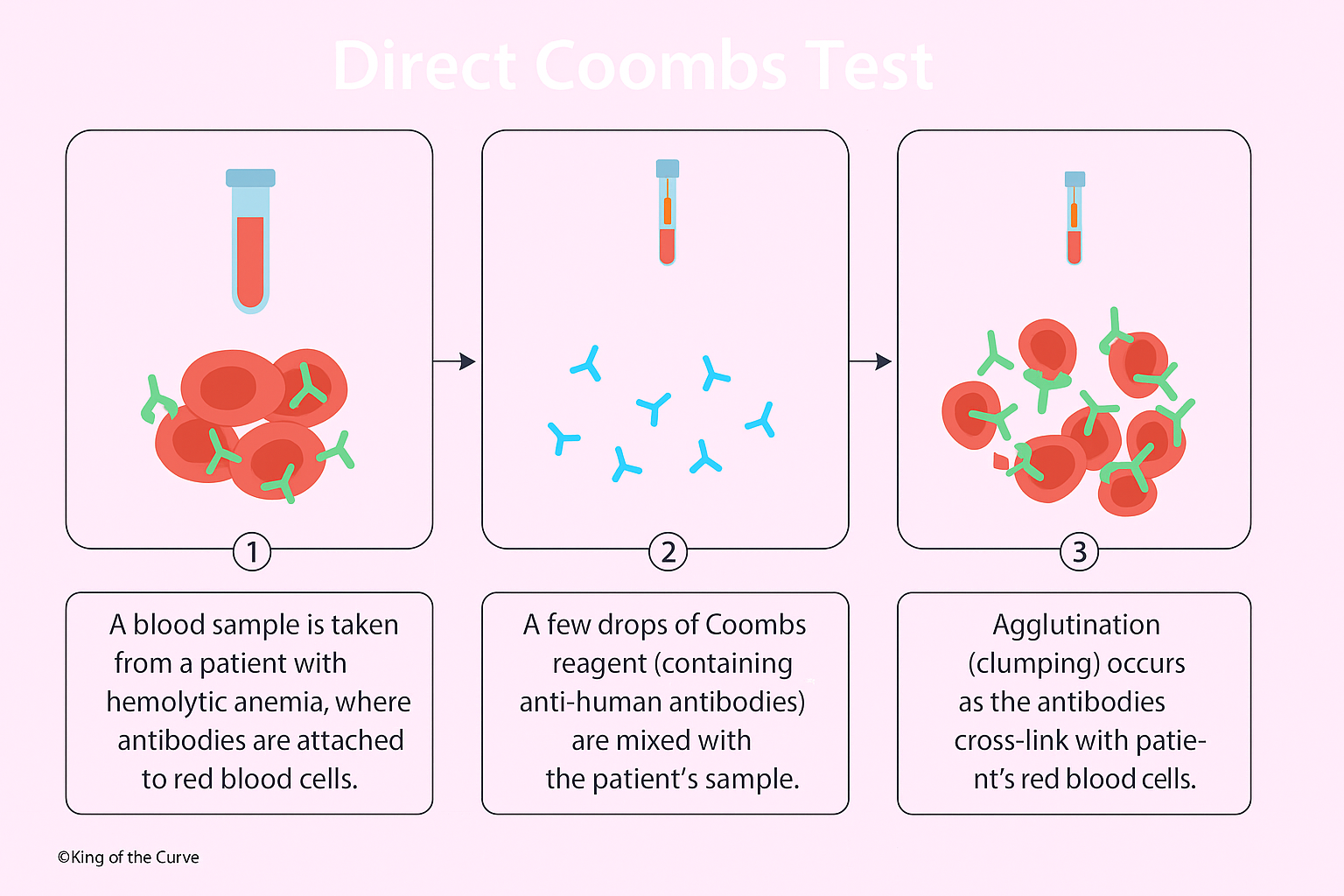 рџ є Direct Coombs Test Detecting Hemolytic Anemia вђ King Of The Curve