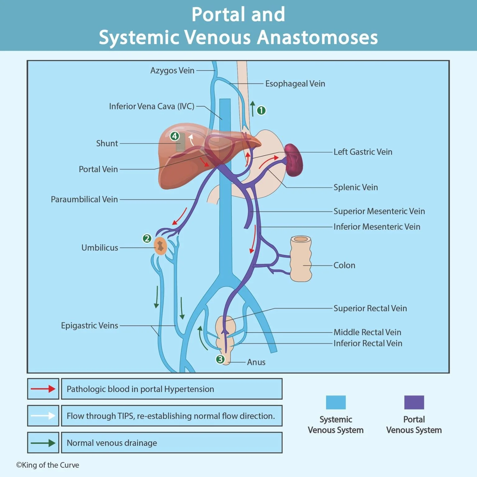 Portal and Systemic Venous Anastomoses: A Complete Guide — King of the ...
