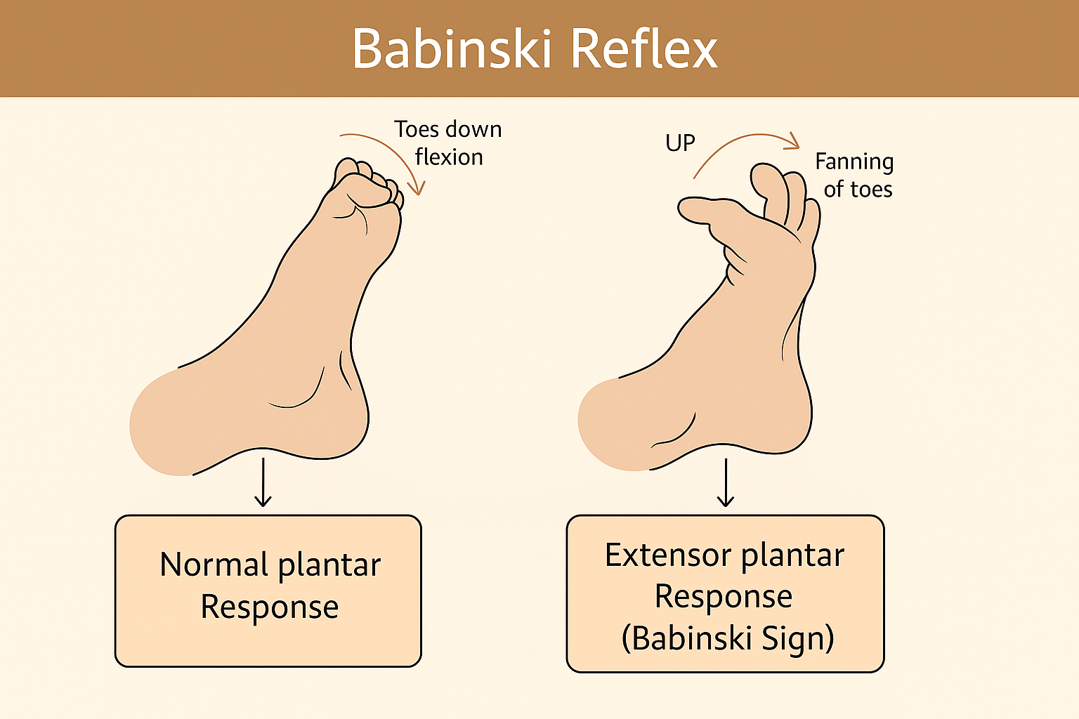 Babinski Reflex for the MCAT: Understanding Plantar Responses — King of ...