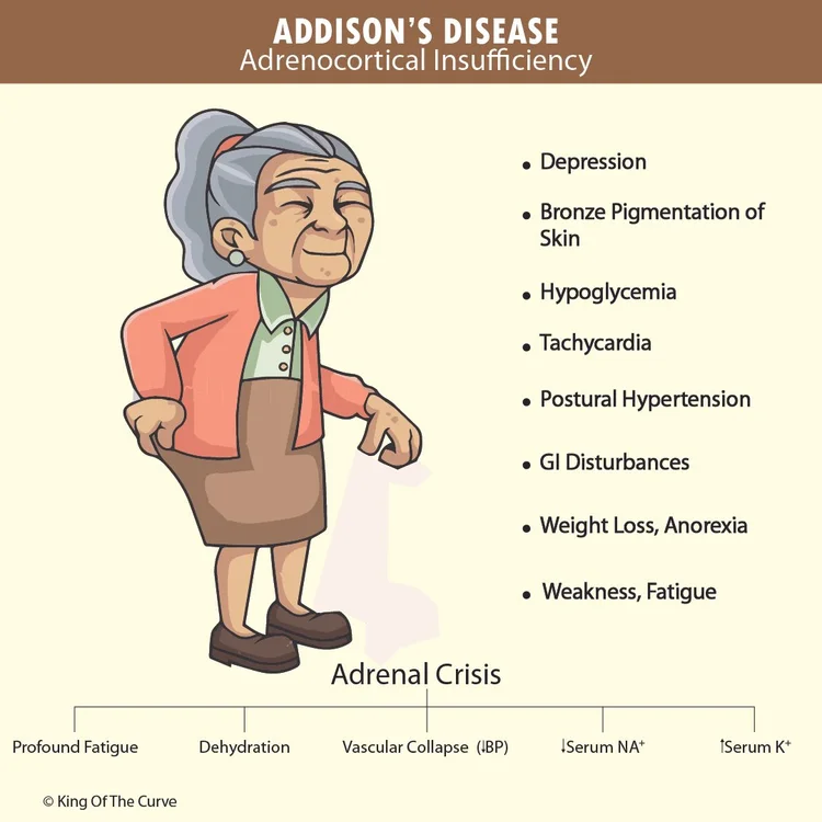 Addison’s Disease NCLEX Guide – Symptoms, Adrenal Crisis & Nursing Care ...