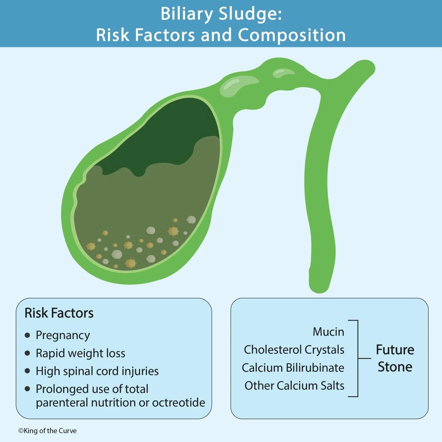 🩺 Biliary Sludge: Risk Factors and Composition Explained — King of the ...