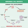 Abnormal Cell Growth: Understanding Cancer Development for the MCAT ...