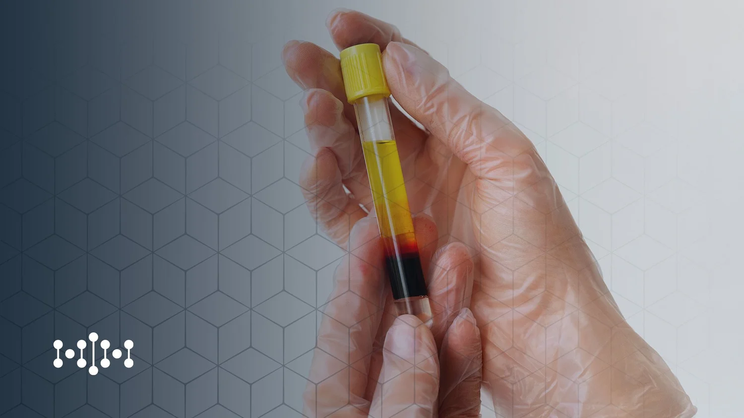 PRP Injections — Bioadvanced Medical Center