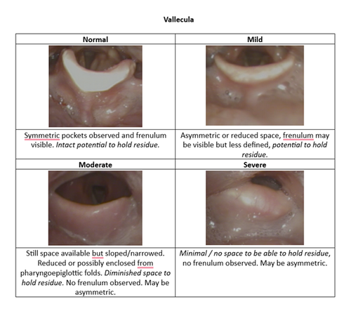 Analysis for FEES and MBSS
