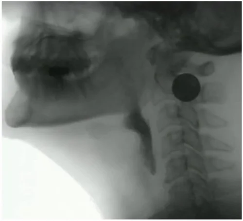 Analysis for FEES and MBSS
