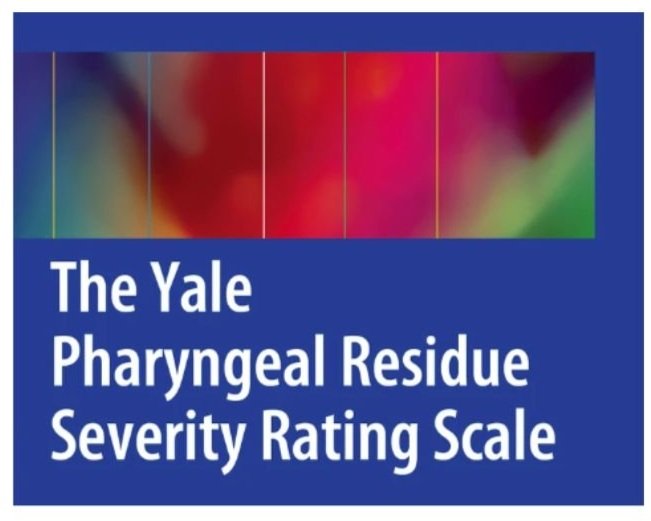 Analysis for FEES and MBSS