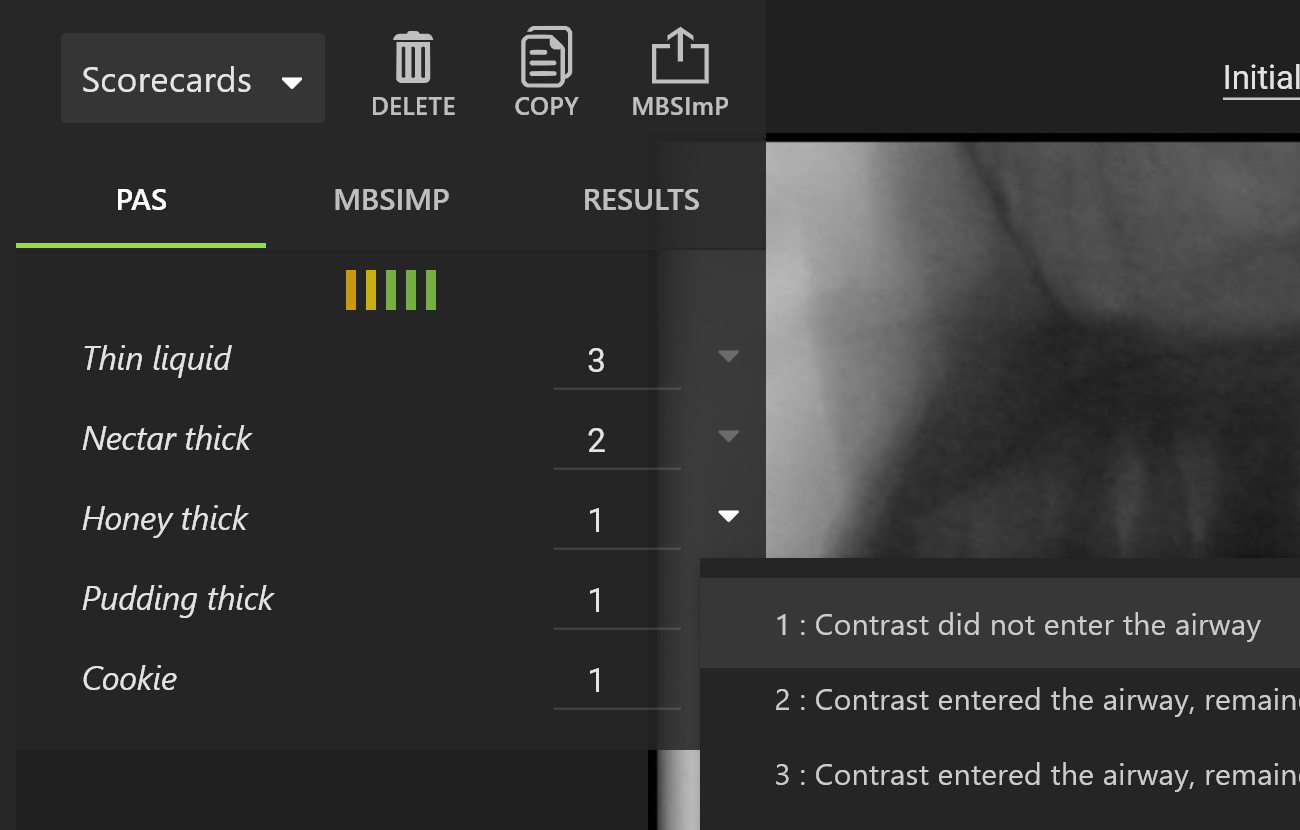 TIMS Review | TIMS Medical