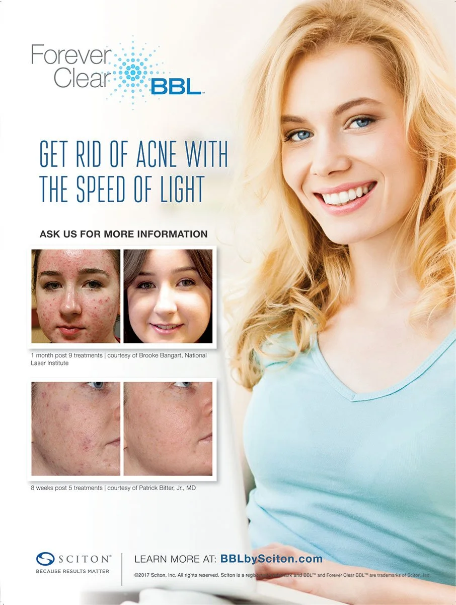 Forever Clear Acne BBL Photo Facial - IPL Laser Manchester NH ...