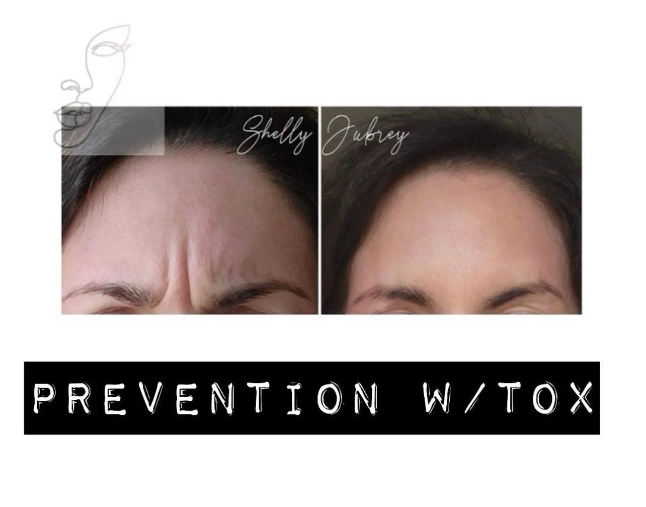 Bombshell Aesthetics & Medical Spa in Manchester NH