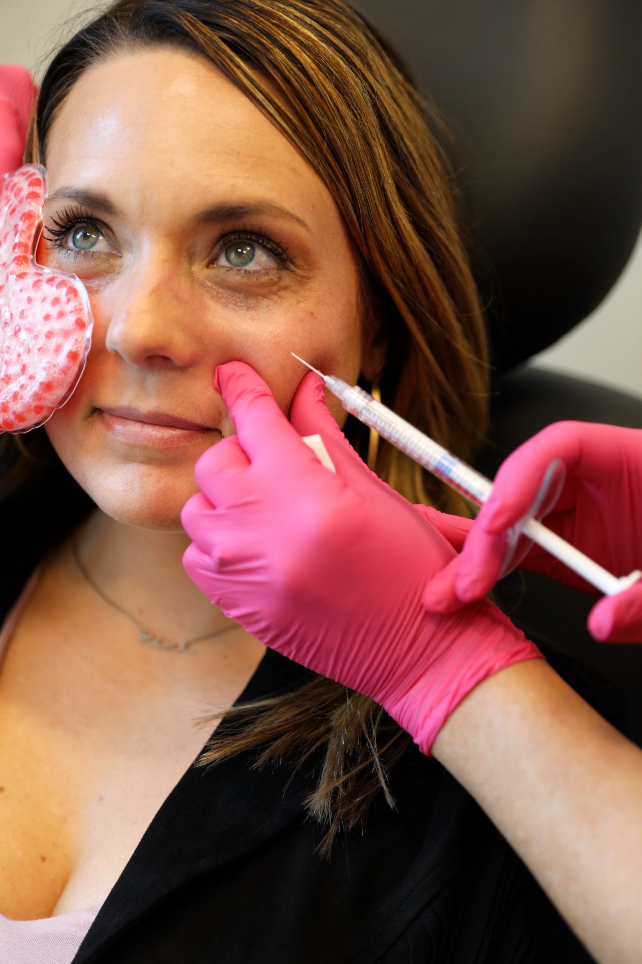 Biostimulating Filler — Gunn Dermatology