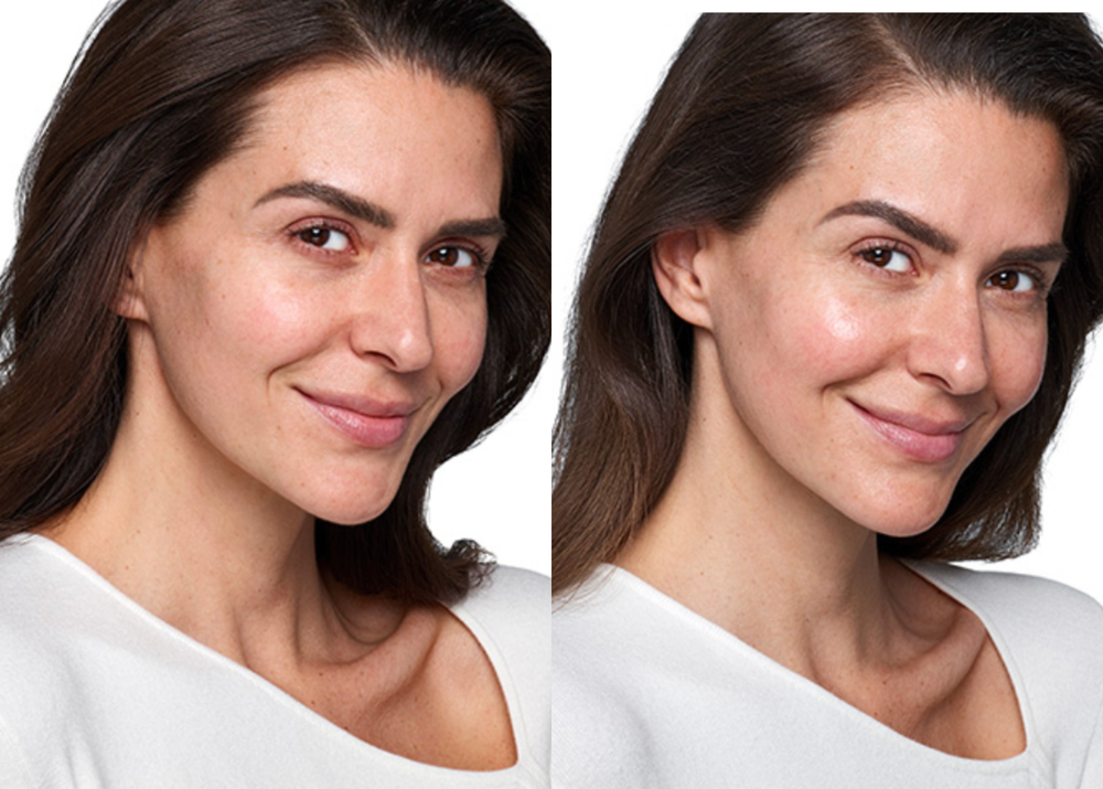 Skinvive — Gunn Dermatology