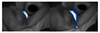BeamSite: Real-Time Treatment Visualization for the Radiation Oncology ...