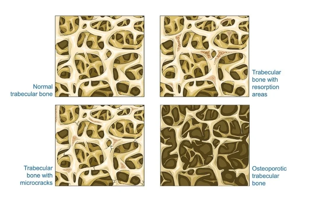 Next generation HRT - Designer Oestrogens — Tanya Borowski Ltd