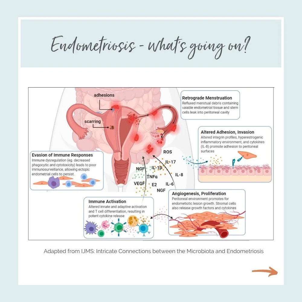 Endometriosis - what’s going on? — Tanya Borowski Ltd