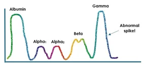 Lab test interpretation for the nurse practitioner: serum protein ...
