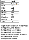 Lab test interpretation for nurse practitioners: Thalassemia — NP Reasoning