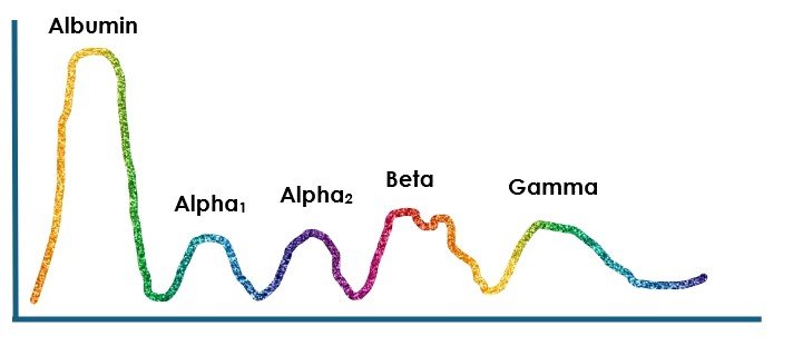 Lab test interpretation for the nurse practitioner: serum protein ...