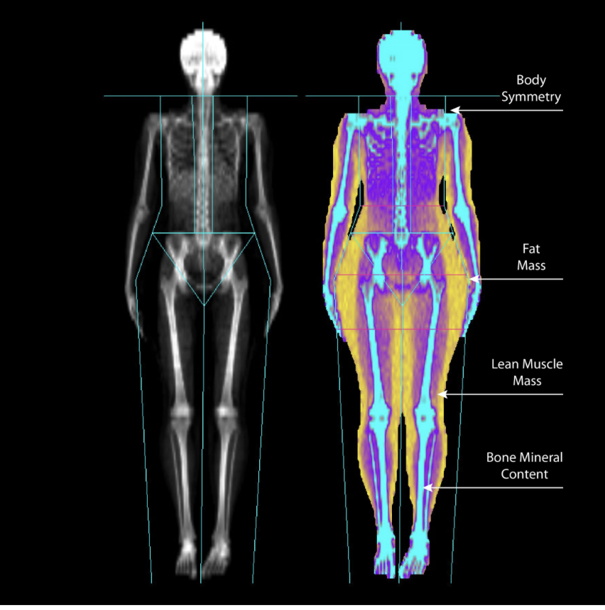 Dexa Scan Body Composition — Body Lounge Park Cities