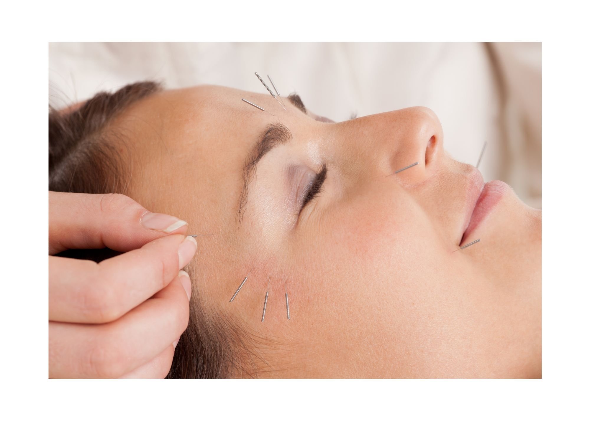 Naturopathic Aesthetics — VitaCare Natural Health Clinic — Nanaimo, BC