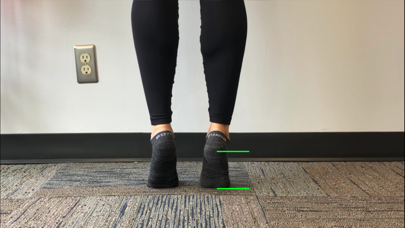 Running: Heel Raises, How & Why — Precision Physical Therapy
