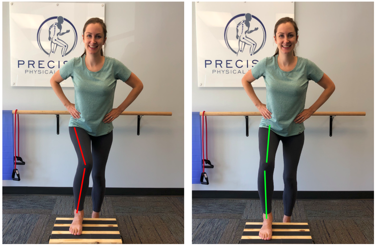 Pure Barre: Knee Valgus Posture — Precision Physical Therapy