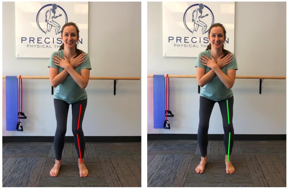 Pure Barre: Knee Valgus Posture — Precision Physical Therapy