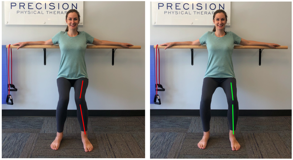 Pure Barre: Knee Valgus Posture — Precision Physical Therapy