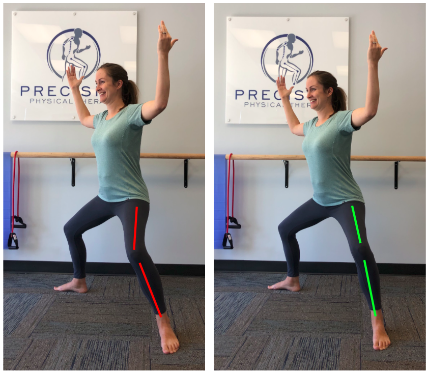 Pure Barre: Knee Valgus Posture — Precision Physical Therapy