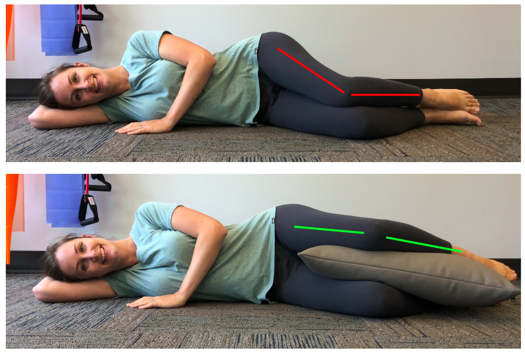 Pure Barre: Knee Valgus Posture — Precision Physical Therapy