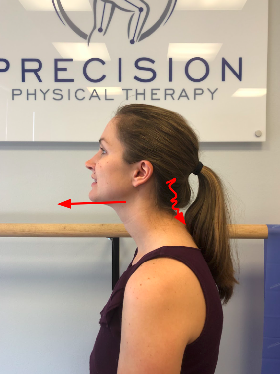 Pure Barre: How to Correct Forward Head Posture during Function and ...