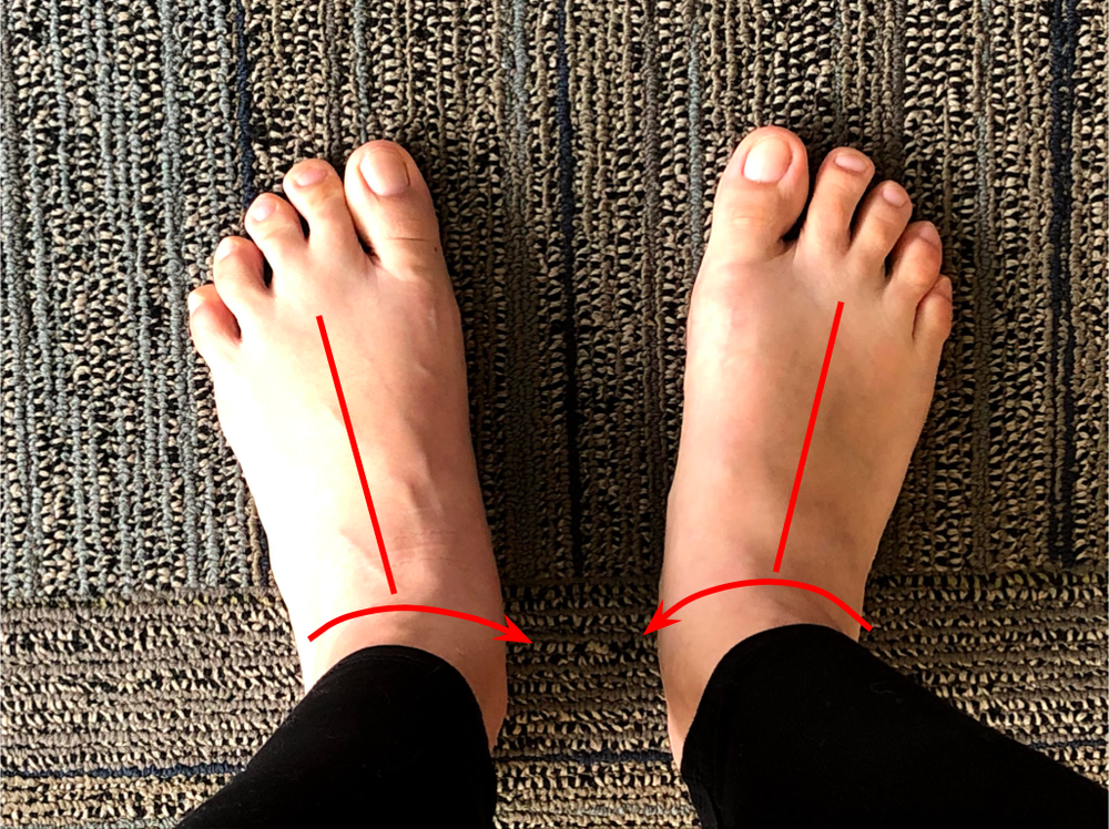 Pure Barre: Foot Posture Corrections — Precision Physical Therapy