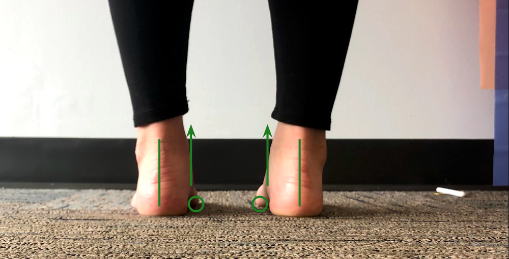 Pure Barre: Foot Posture Corrections — Precision Physical Therapy