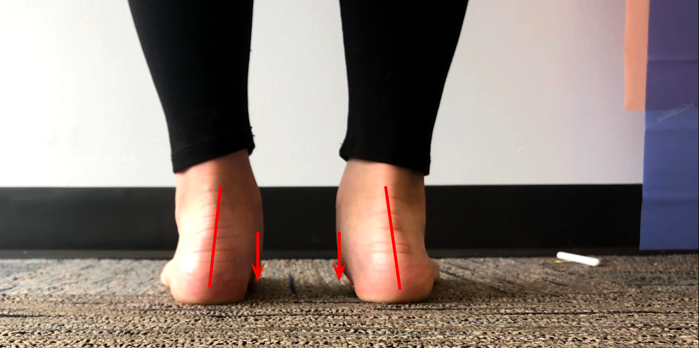 Pure Barre: Foot Posture Corrections — Precision Physical Therapy